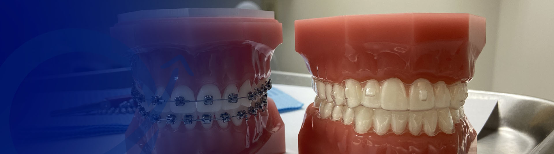 Common Orthodontic Issues | Ottawa, ON | Barrhaven Orthodontics ...